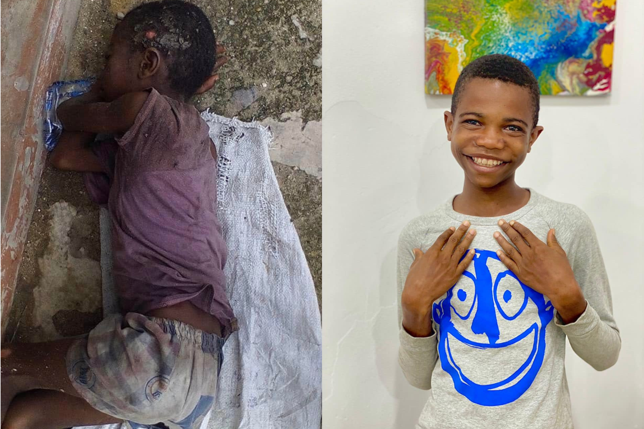 Amazing transformation of young boy rescued from the streets 5 years ...
