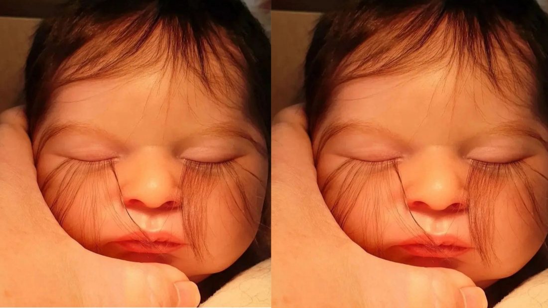 Baby diagnosed with Eyelash Trichomegaly after being born with lashes ...